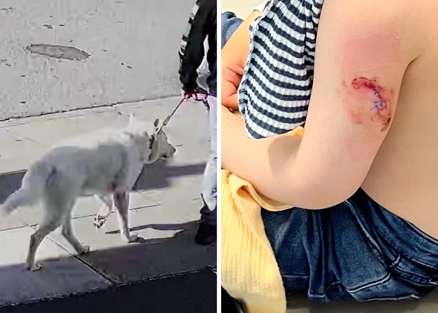 Video: Off-leash husky owners cited after ‘vicious’ attack on boy, 4